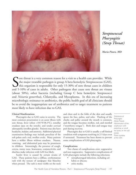 What Does A Normal Healthy Throat Look Like