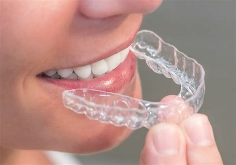 Removable Orthodontic Retainers In Toronto Atlas Dental