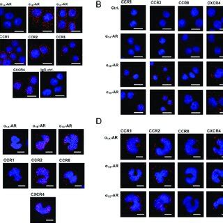 CR α B D AR heteromers after α B D AR siRNA knockdown THP cells Download Scientific