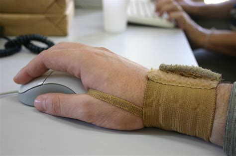 Repetitive Motion Injuries And New Jersey Workers Compensation Top