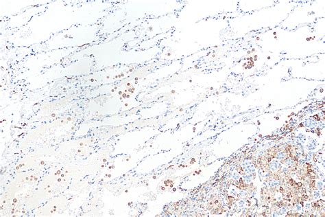 Cd206 Antibody 81525 1 Rr Proteintech 武汉三鹰生物技术有限公司