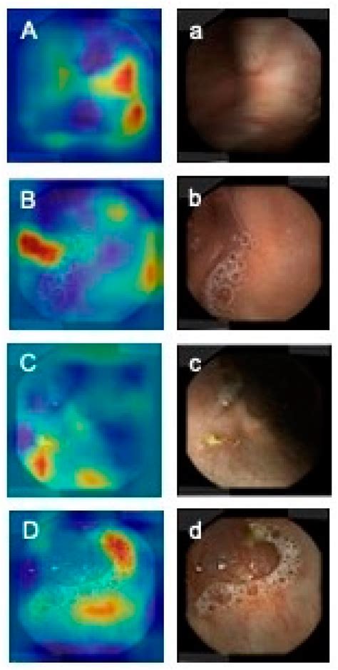 Automatic Classification Of Gi Organs In Wireless Capsule Endoscopy