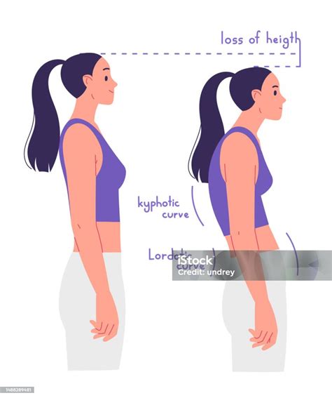 Correct And Incorrect Posture The Disadvantages Of Poor Posture And The Consequences Of