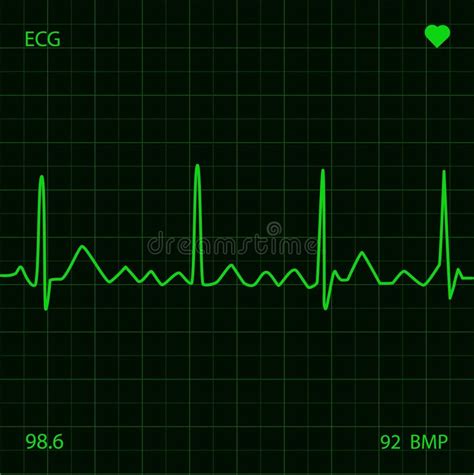 Heart Monitor Screen Stock Vector Illustration Of Emergency 4819539