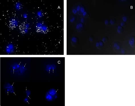 Uptake Of NINPs By Cultured CHO K1 Cells As Assessed By Combined Dark