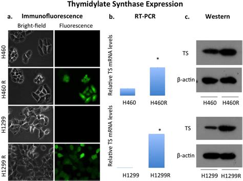 Overexpression Of Thymidylate Synthase In Nsclc Cell Lines H460 And