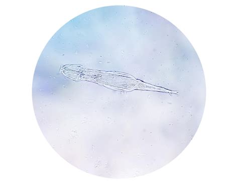 현미경으로 인간의 소변 표본에 있는 Schistosoma Haematobium 기생충 요로 기생충 프리미엄 사진