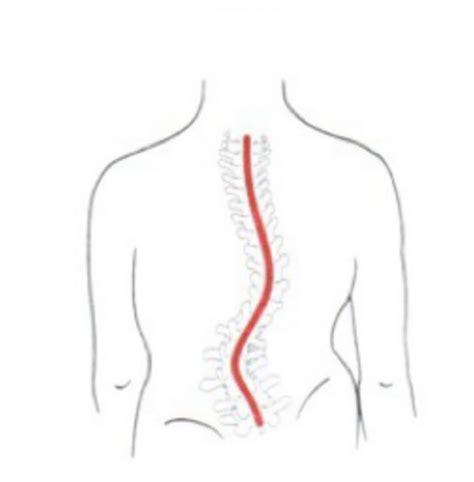 Retention Optimization Quizzes Flashcards Quizlet