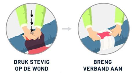 6 Essentiële Stappen Bij Acute Levensbedreigende Bloedingen Evac
