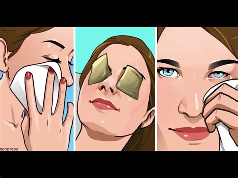 Лечение конъюнктивита народными средствами