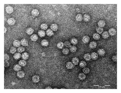 Electron Micrograph Of Recombinant PPV VP2 VLPs In CsCl Fraction A