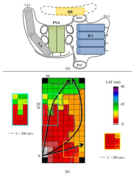 Method Of Epicardial Mapping A Mapping Scheme On A Schematic Download Scientific Diagram
