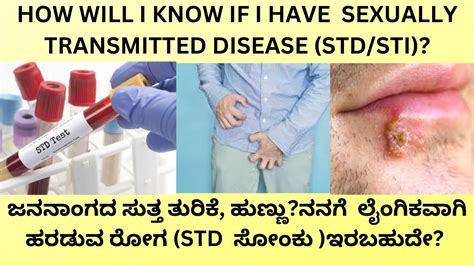 Urethral Swab Std Test At Lucy Sutcliffe Blog