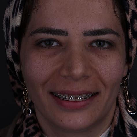 دکتر شهاب الدین عزیزی؛ جراح، فلوشیپ و انکولوژیست فک و صورت