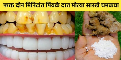 तंबाखू गुटखा खाऊन कितीही जुनाट झालेले पिवळे दात फक दोन मिनिटांत