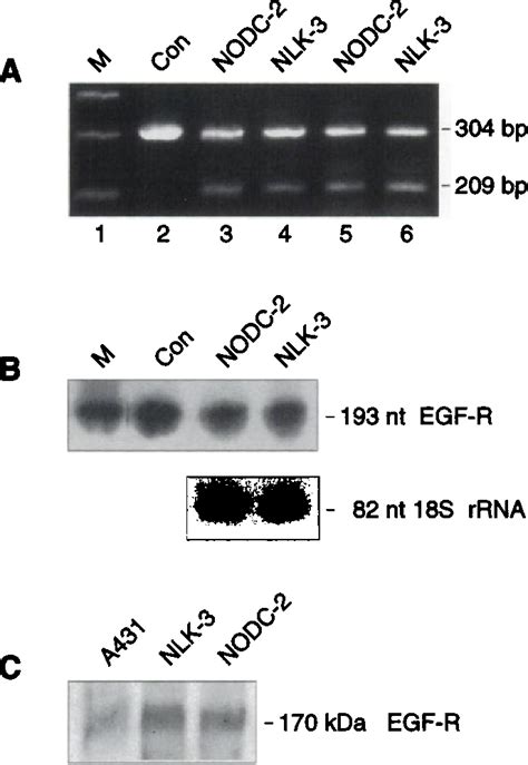 Figure 1 From Ornithine Decarboxylase Transformation Of Nih3t3 Cells