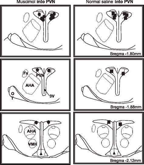 Figure 1 From Hypothalamic Paraventricular Nucleus Is Critical For Renal Vasoconstriction