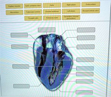 SOLVED Aortic Semilunar Valve Aorta Right Atrium Endocardium Papillary Muscles Trabeculae