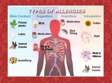 Hypersensitivity And Its Types Type 1 Anaphylaxis Type 2 Type 3 Type 4 Pptx Allergies