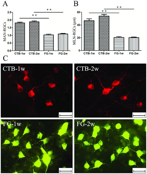 The Morphology Of Cholera Toxin Subunit B Ctb Retrograde Labeled And Download Scientific