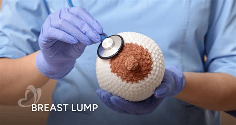 Breast Lump Guide Types Warning Signs And When To See A Doctor