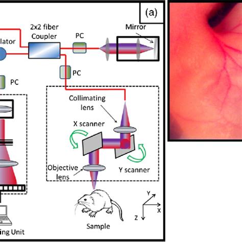 A Normal Pattern Of Lymphoscintigraphy Of The Lower Limbs Figure 2 An Download Scientific