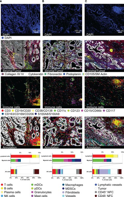 Unveiling Spatial Complexity In Solid Tumor Immune Microenvironments Through Multiplexed Imaging