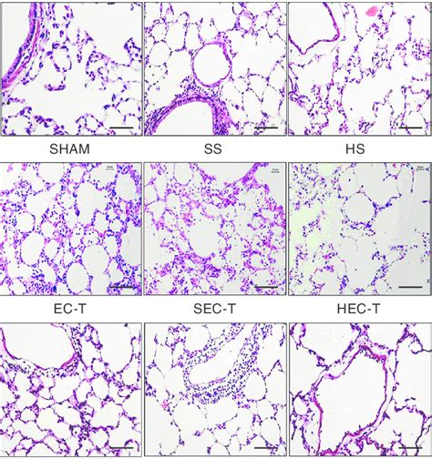 Lung Healthy Histology Tamr Kprrumahsyariah