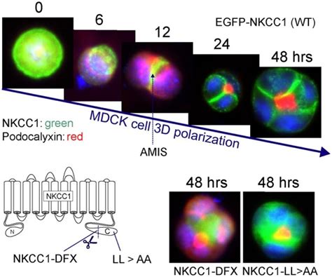 Nkcc1 Newly Found As A Human Disease Causing Ion Transporter Pmc