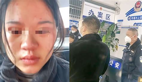 【掌闻视讯】远嫁女子被公公家暴：当着她1岁儿子面打，醒来时已在医院 粉丝数106073 作品数63066 资讯视频 免费在线观看 爱奇艺