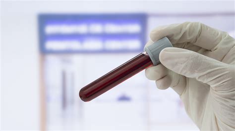 Qué Y Cuáles Son Los Más De 100 Tumores De La Sangre Que Existen Infobae