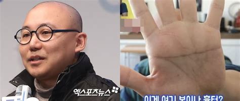 강도 피해 주호민 손 흉터 공개…2~3개월간 아파 [종합] 나무뉴스