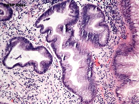 Hsp Atlas Histopathology Atlas Gi Tract