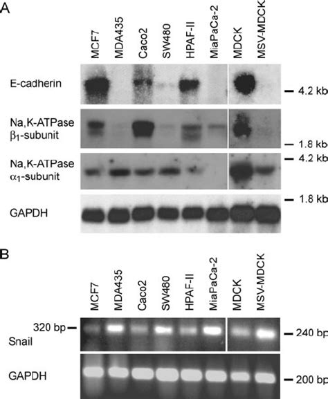 Correlation Between E Cadherin Nak Atpase ␣ 1 Subunit ␤ 1 Subunit Download Scientific