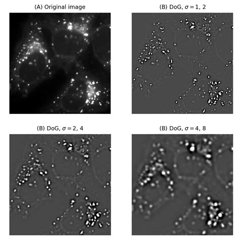 Spot Detection — Day 2 Intro To Bioimage Analysis With Python For Life Scientists A