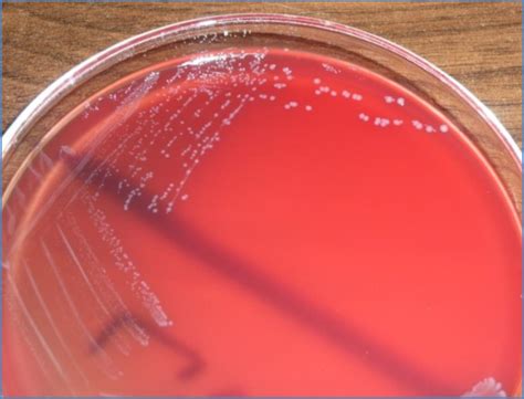 The Colonial Morphology Of P Multocida Isolates On 5 Sheep Blood