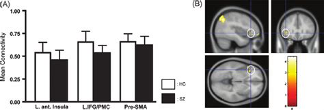 Functional Connectivity Analysis Of Visual Verbal Working Memory A