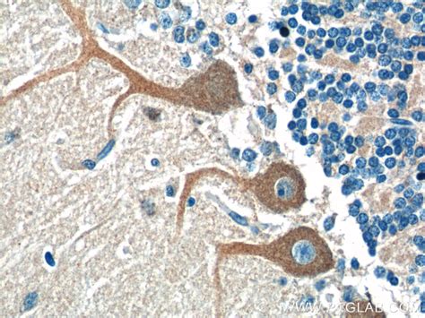 Csf1r Cd115 Antibody 25949 1 Ap Proteintech