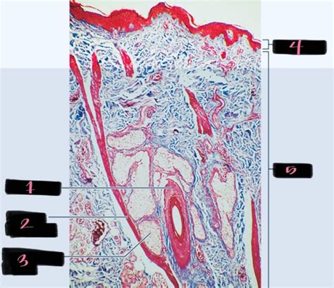 Midterm Exam Review SKIN Diagram Quizlet