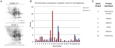 Comparative Proteomic Profiling Using Two Dimensional Gel Electrophoresis And Identification Via
