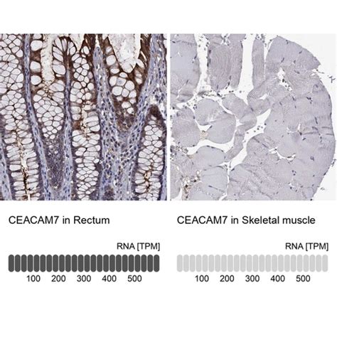 Rabbit Polyclonal Anti Ceacam7 Antibody Buy For Research Highly