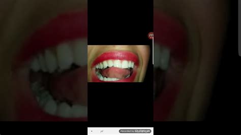 Girl Biting Destroy Finger Youtube