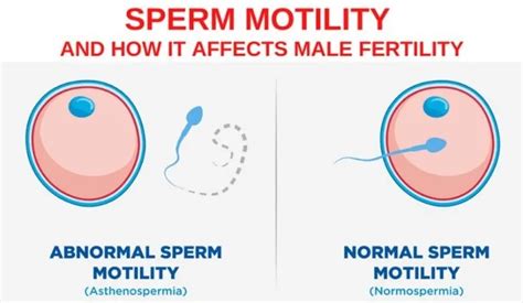Healthy Sperm Improving Your Fertility Nisha Ivf Centre