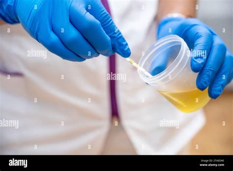 Close Up Of Nurse Hand Holding Urine Sample Container For Medical Urine