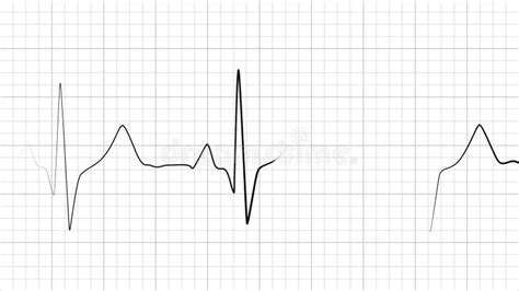 Dynamic Heart Rate Or Heart Beat Line Cardiogram Signal Stock Illustration Illustration Of