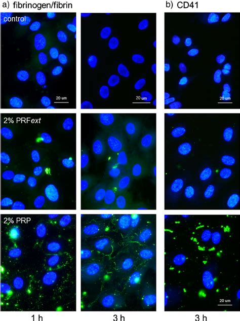 Immunofluorescence Examination Of Fibrin Fiber Formation A And Cd41
