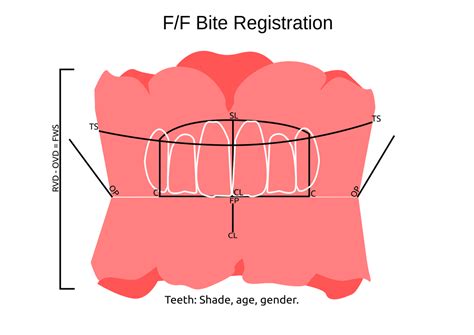 Blog Bremadent Dental Laboratory