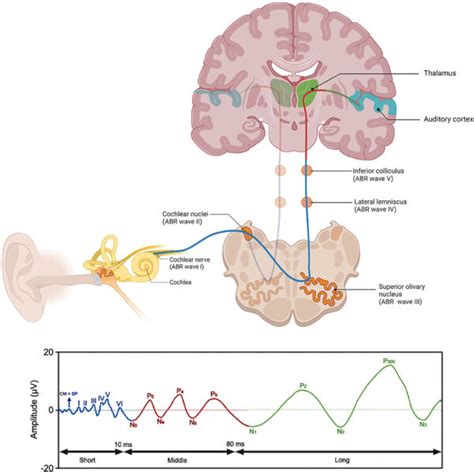 Evoked Potentials Modalities And Anesthetic Effects Openanesthesia