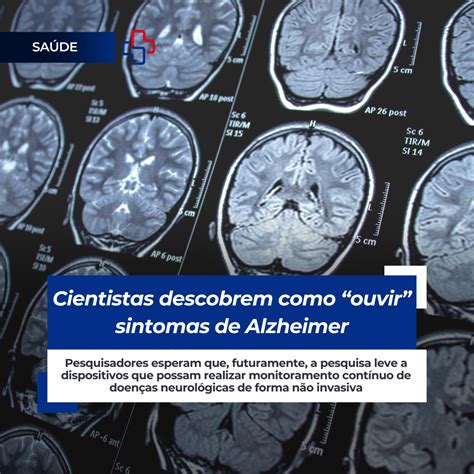 Cientistas Descobrem Como Ouvir” Sintomas De Alzheimer Sindees