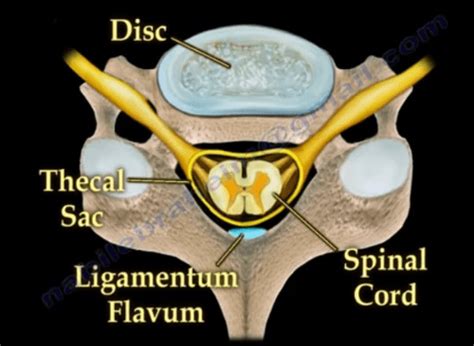 Spinal Cord And Thecal Sac